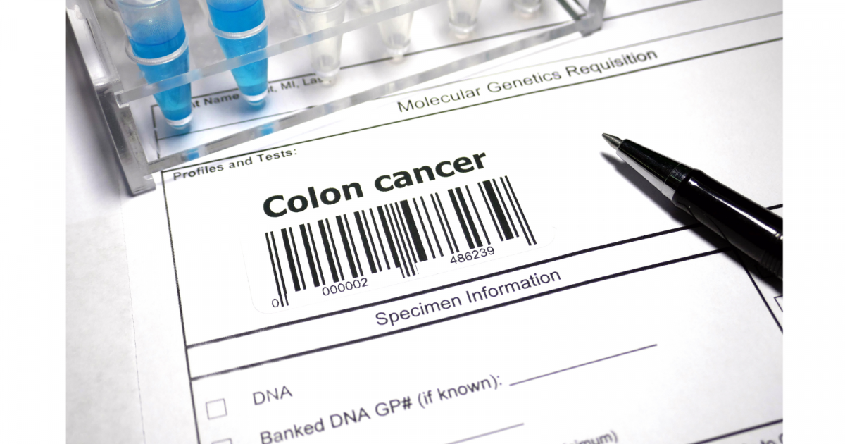 Ryan Health | Colorectal Cancer Screening Could Save Your Life